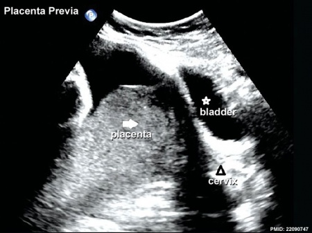 BGDA Practical Placenta - Diagnostic Techniques - Embryology