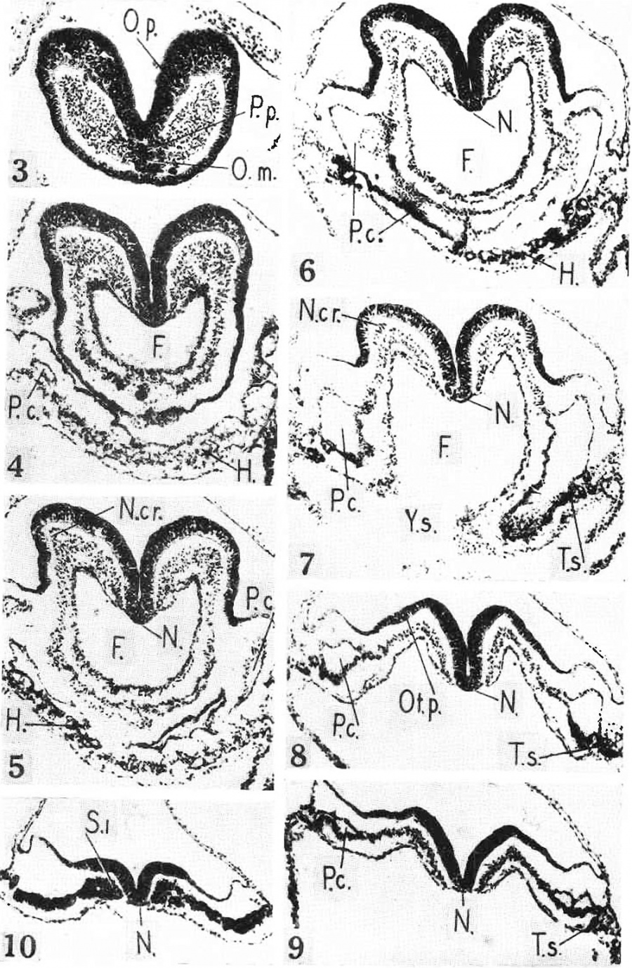 Paper - A human embryo of two to three pairs of somites (1945) - Embryology
