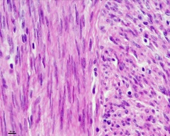 Smooth Muscle Development - Embryology