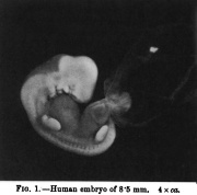 Category:Carnegie Stage 15 - Embryology