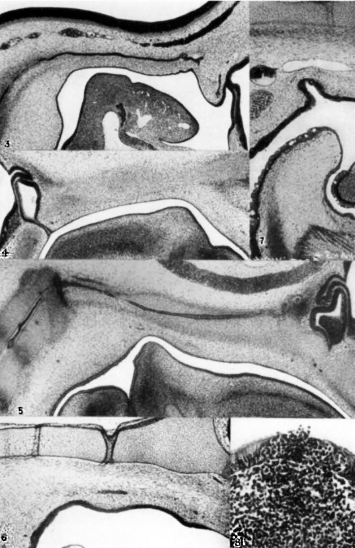 Paper - The developmental significance of the mammalian pharyngeal ...
