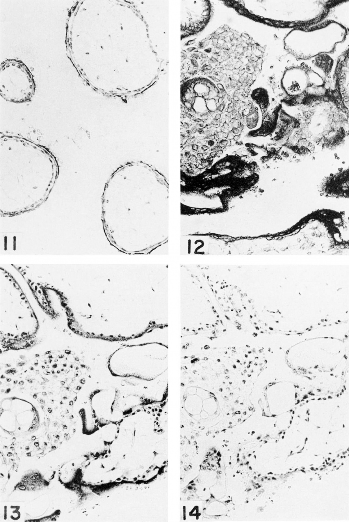Paper - Histochemical horizons in human embryos - Stage 13 - Embryology