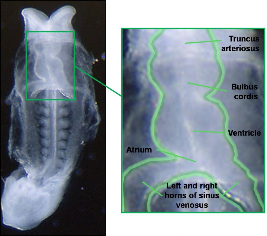 Talk:Basic - Primitive Heart Tube - Embryology