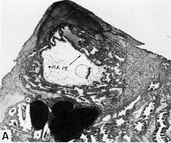 Paper - lnvolution of tissues in fetal life (1946) - Embryology