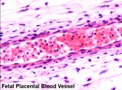 Lecture - Early Vascular Development - Embryology