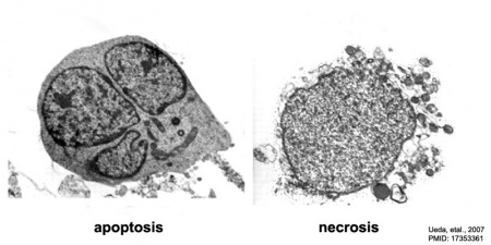 Developmental Mechanism - Apoptosis - Embryology