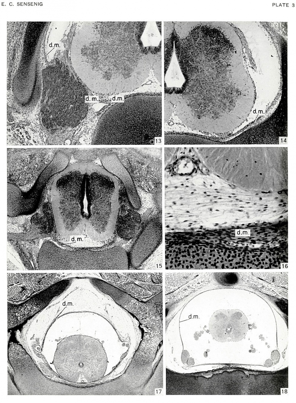 Paper - The early development of the meninges of the spinal cord in ...