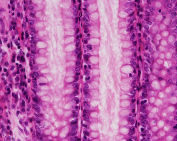 Gastrointestinal Tract - Colon Histology - Embryology