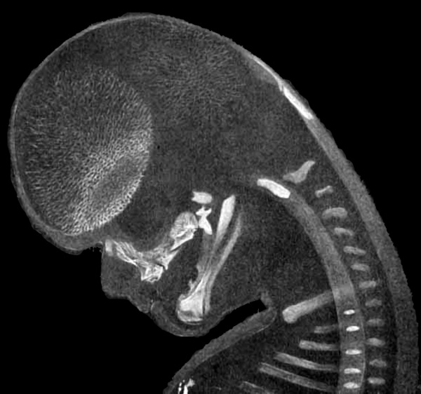 BGDB Face and Ear - Fetal - Embryology