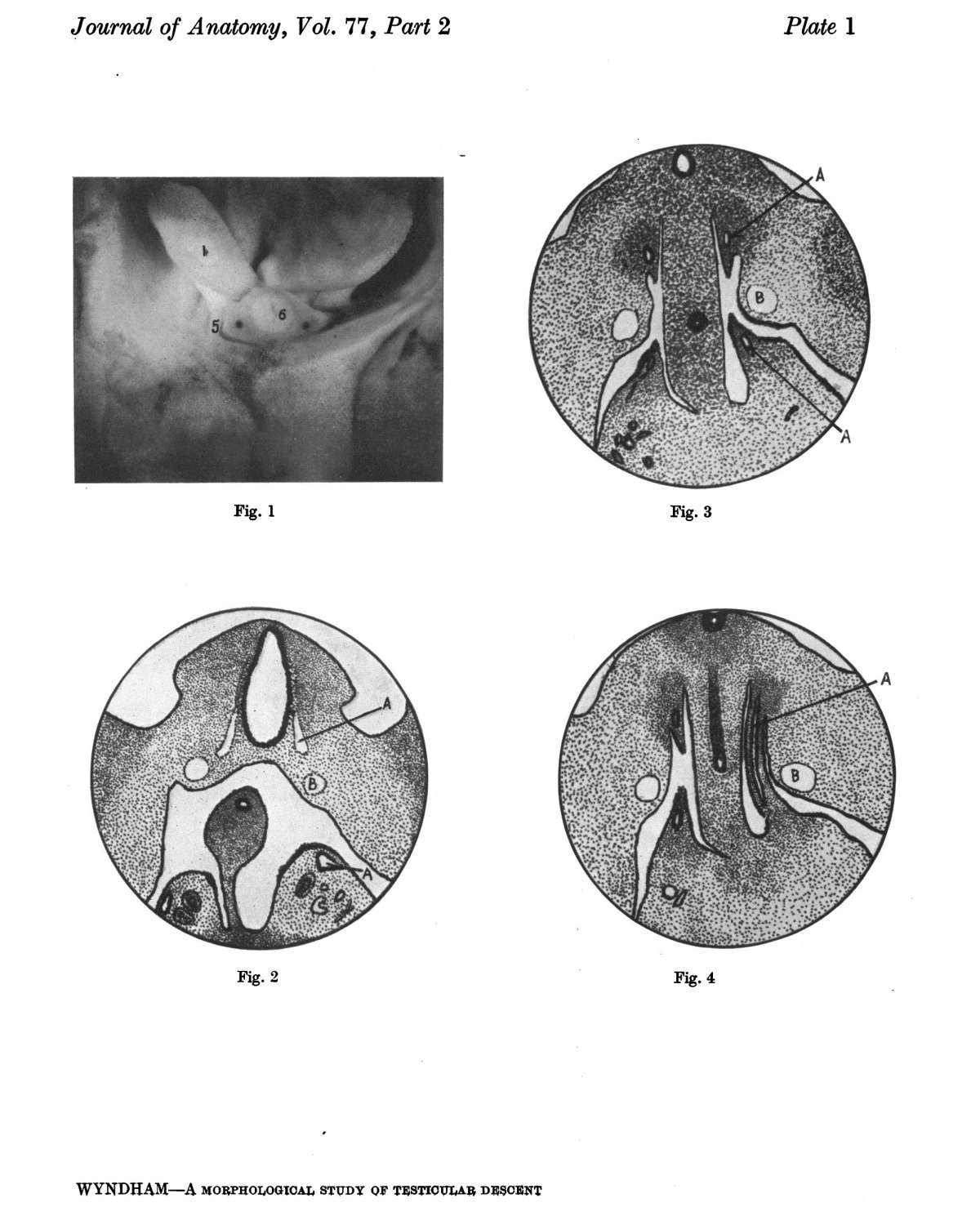 Paper - A morphological study of testicular descent - Embryology