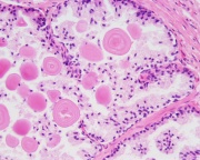 Prostate Development - Embryology