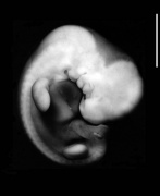 Carnegie stage 15 - Embryology