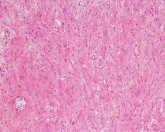 Prostate Development - Embryology