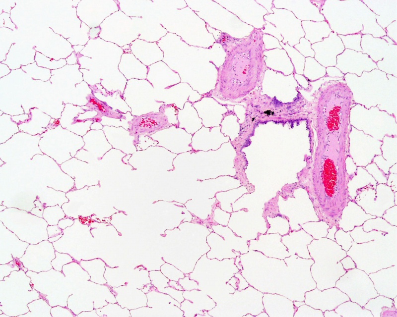 SH Practical - Respiratory - Embryology