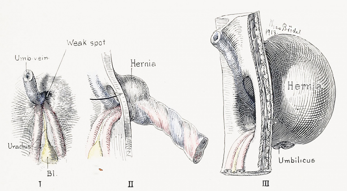 Book - Umbilicus (1916) 1 - Embryology