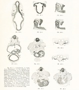 Book - Normal plates of the development of the human embryo (1908 ...
