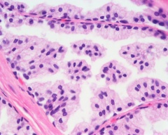 Prostate Development - Embryology