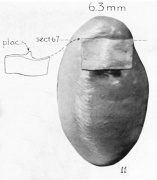Category:Placode - Embryology