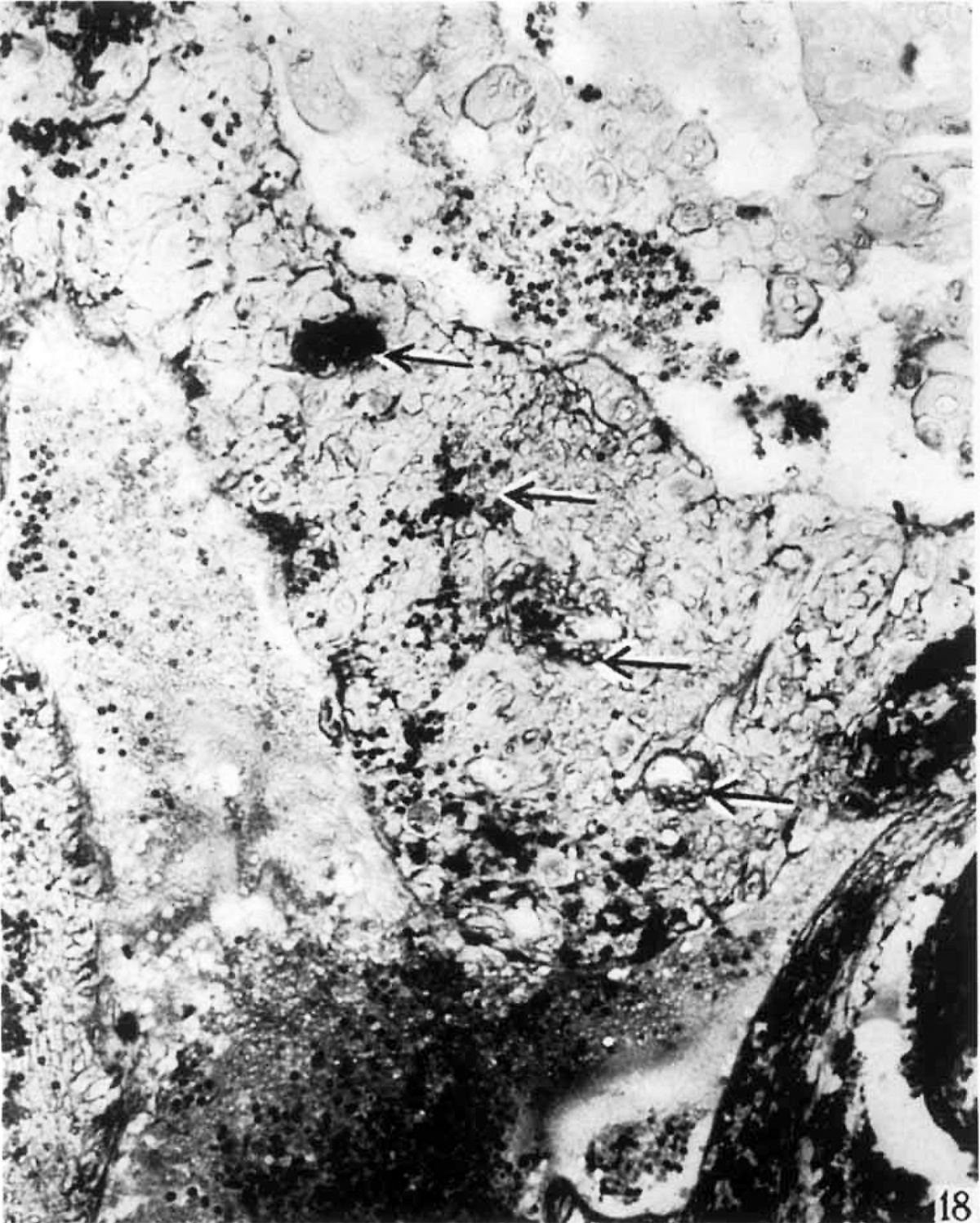 Paper - A normal human ovum in a stage preceding the primitive streak ...