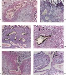 Paper - Development of the human placenta in the first three months of ...