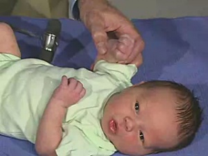 Neural Exam - Newborn tone - hand position - Embryology