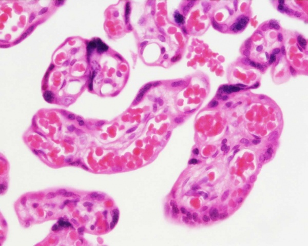 BGDA Practical Placenta - Villi Development - Embryology