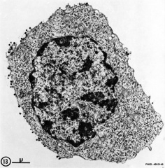 Lymph Node Development - Embryology
