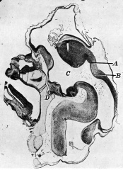Endocrine - Pineal Development - Embryology