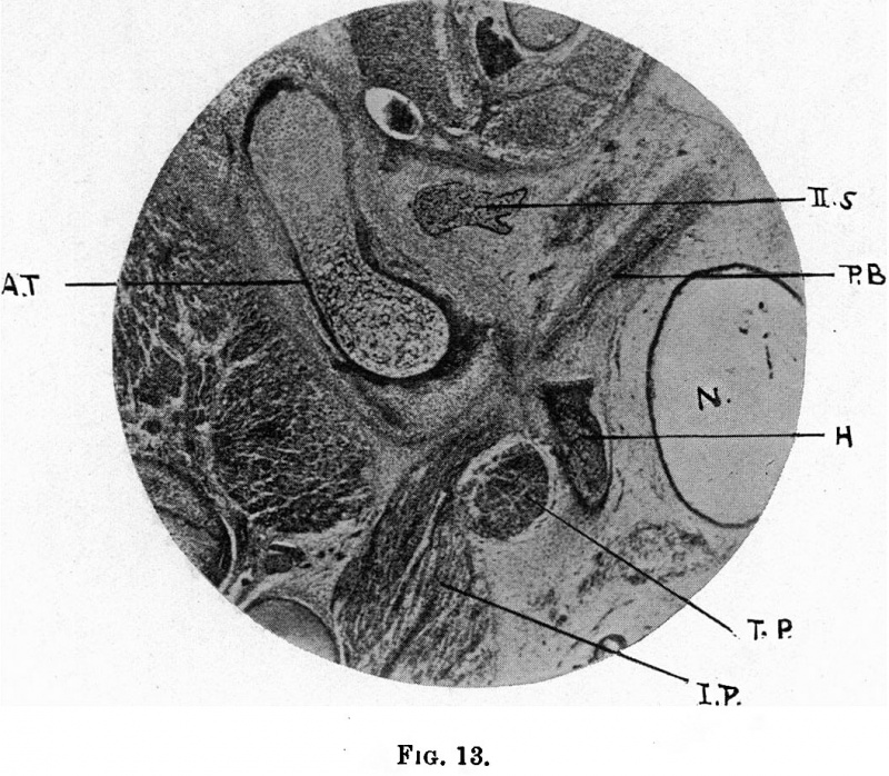 Paper - Notes on the development of the human sphenoid (1910) - Embryology