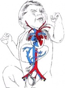 Neonatal Circulation Movie - Embryology