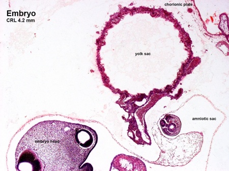 Coelomic Cavity Development - Embryology