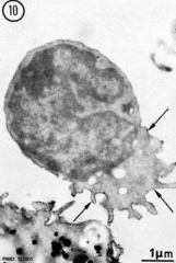 Immune System Development - Embryology