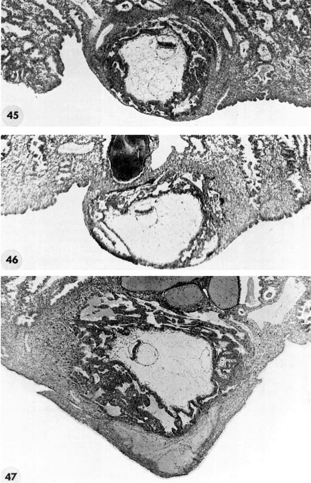 Paper - A description of 34 human ova within the first 17 days of ...